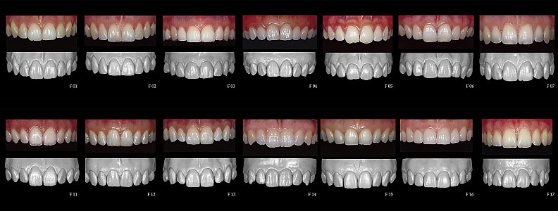 ZRS Library ...не все люди на одно лицо | Блог | DENTCAD